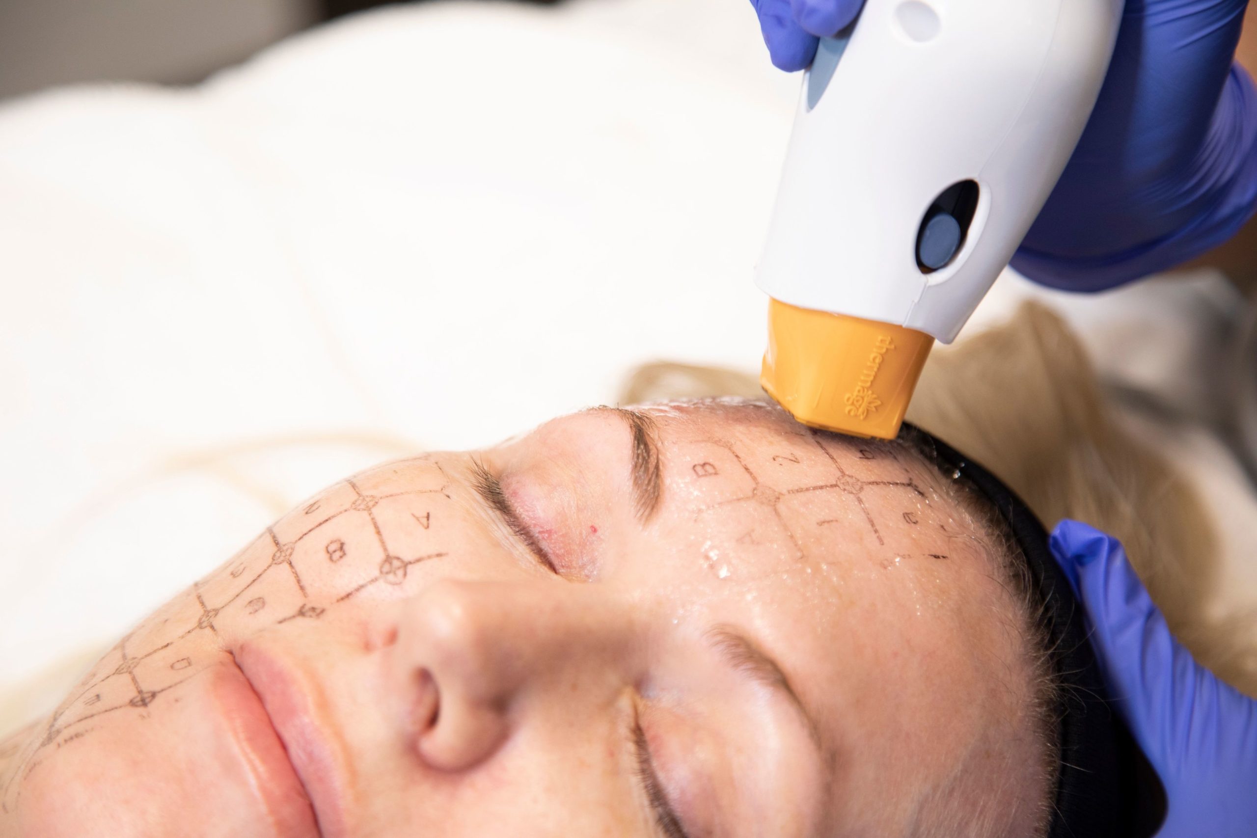 How to Refresh Your Skin